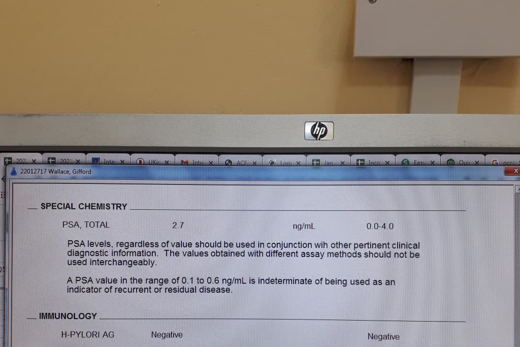 Can A Blood Test Result Be Wrong? – Phlebotomist Report