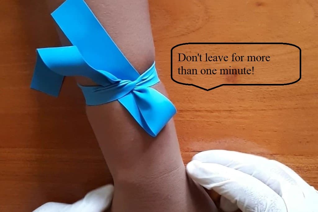When Do You Remove the Tourniquet During a Blood Draw? – Phlebotomist ...